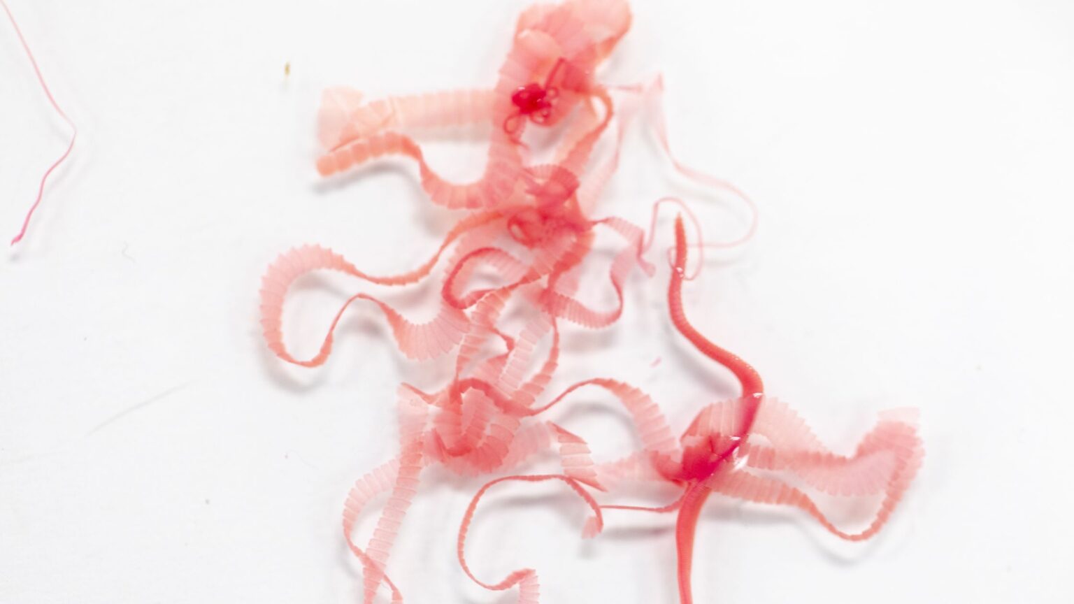 People Horrified After Discovering What a Tapeworm Looks Like Under a ...