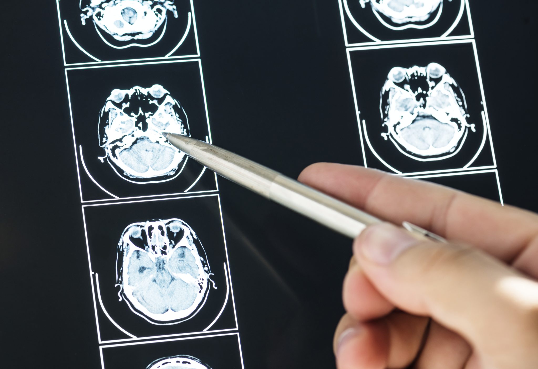 Your Brain Agrees With Buddhist Monks About Who You Really Are